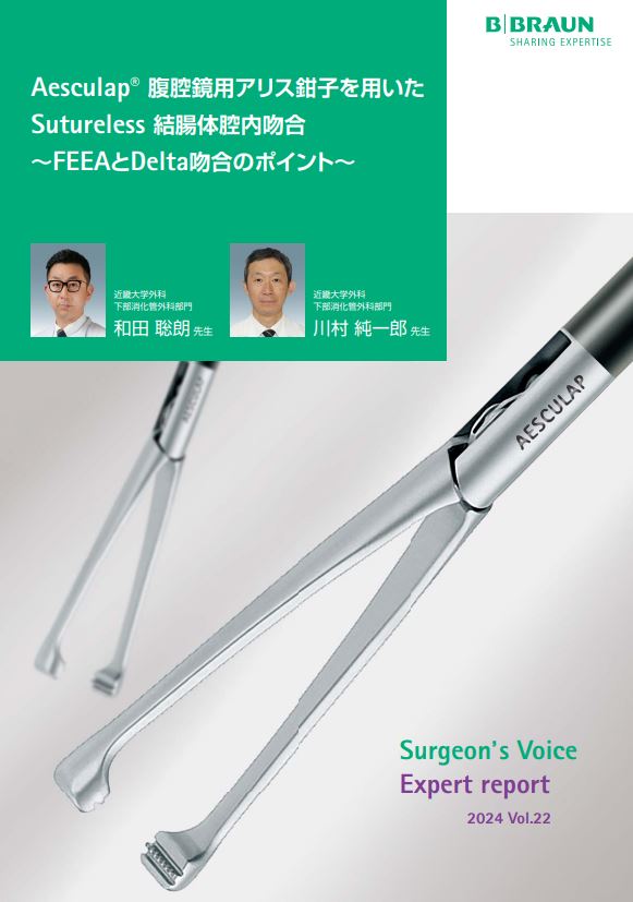 Aesculap腹腔鏡用アリス鉗子を用いたSutureless結腸体腔内吻合～FEEAとDelta吻合のポイント～｜MIS Library ...